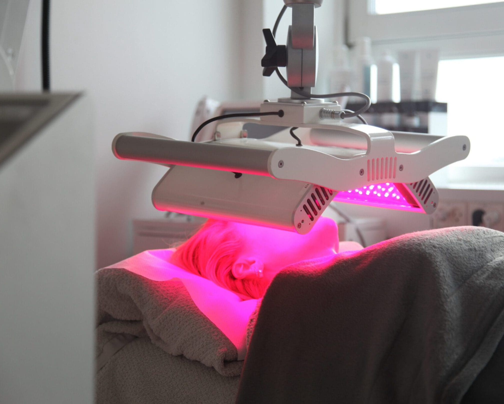 Gigalaser-Behandling i København | Hellerup Laserklinik